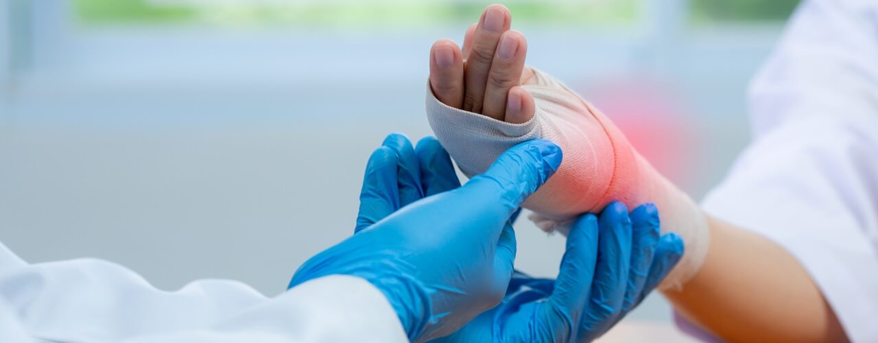 Fractures on the Field: Sports Medicine Approach to Broken Bones